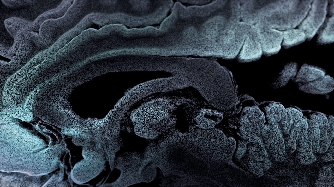 “We want to explore new narratives with EVOLVER” – Sam Pressman (Pressman Film) - XRMust